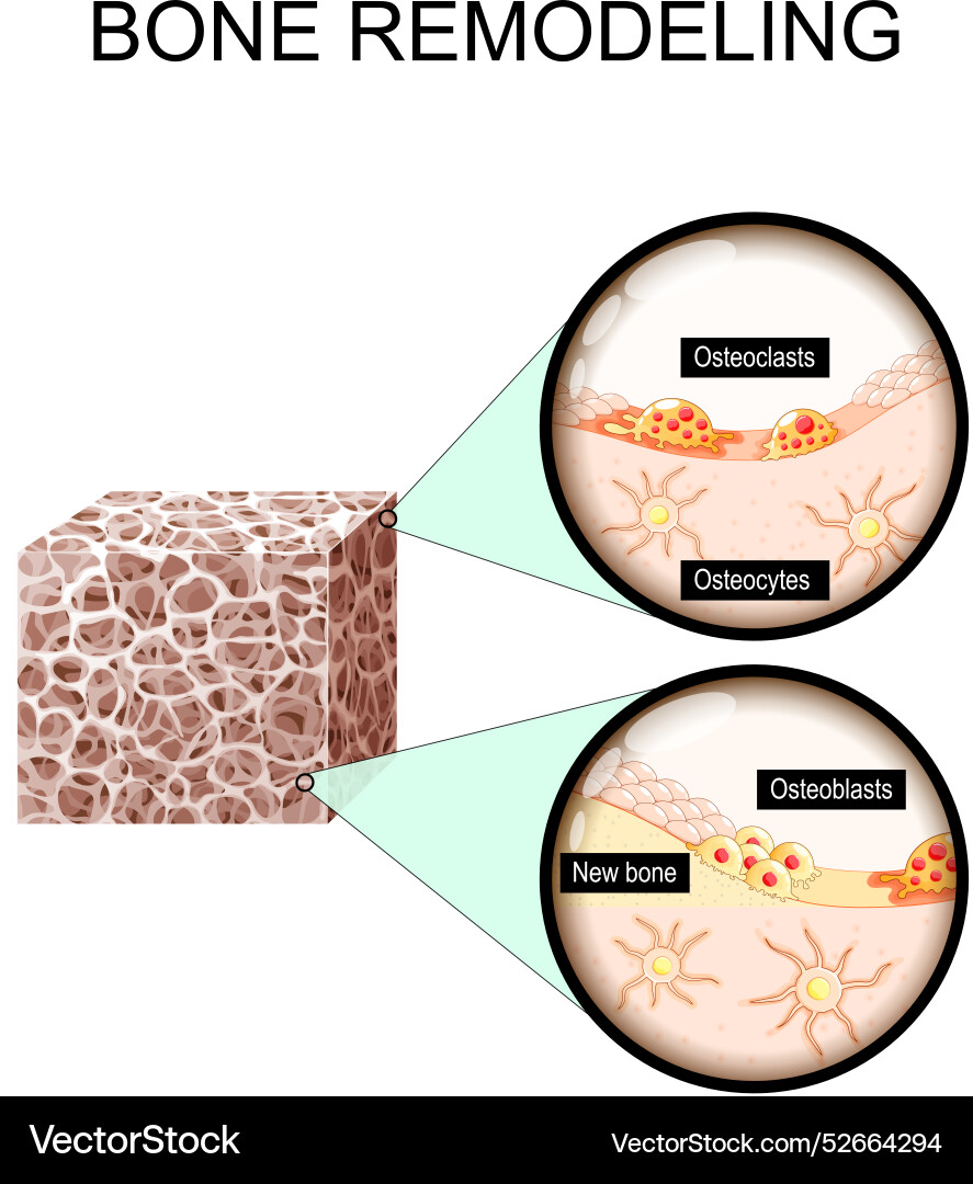 Bone remodeling from resorption to new Royalty Free Vector