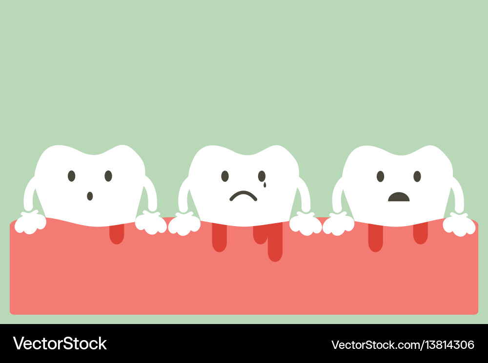 Gingivitis and bleeding Royalty Free Vector Image
