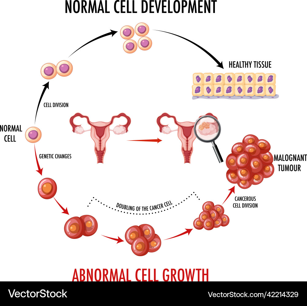 Diagram showing cancer development process Vector Image
