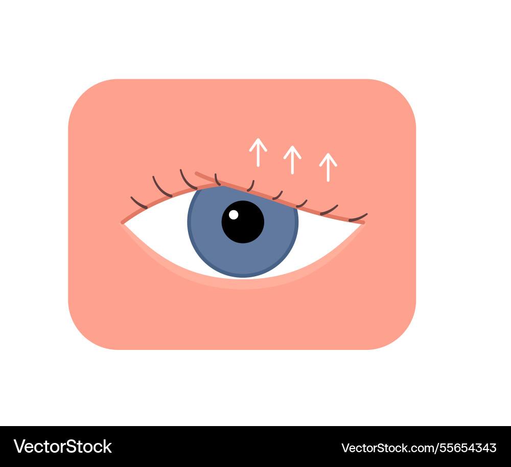 Drooping eyelid with correction blepharoplasty Vector Image