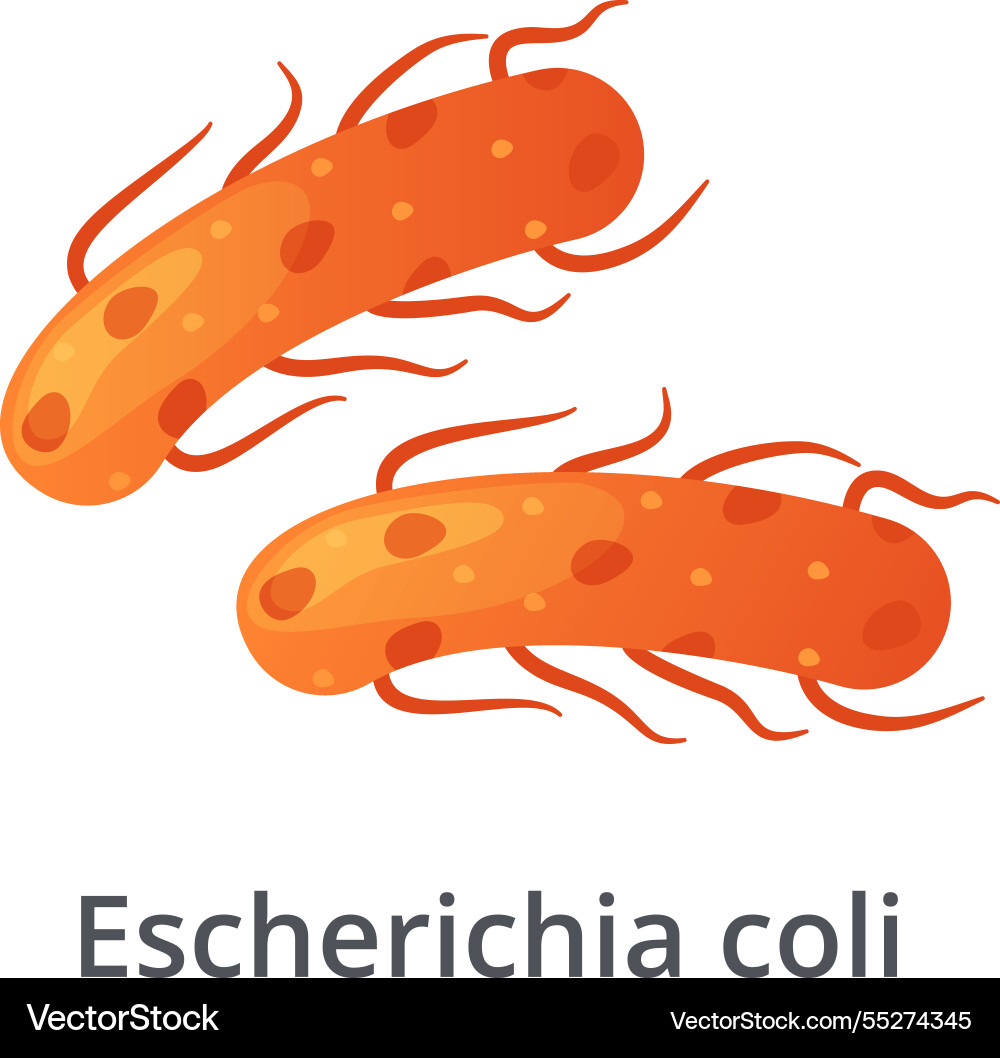 Escherichia coli bacteria is a common cause Vector Image