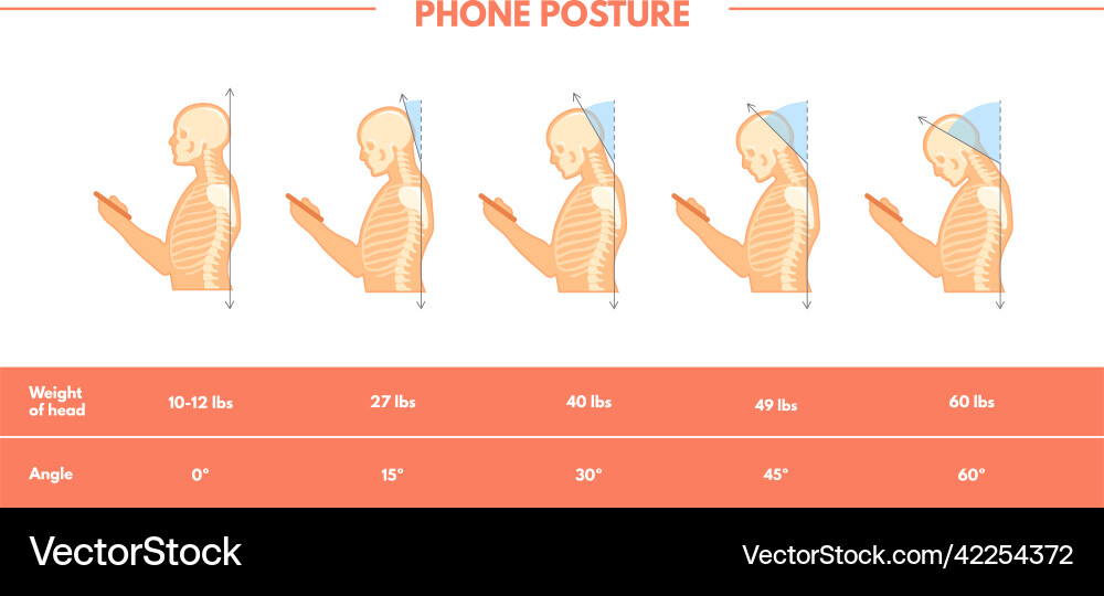 Poor Neck Posture with Phone Royalty Free Vector Image