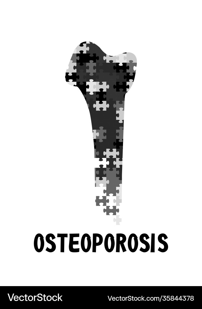 Bone disease concept poster Royalty Free Vector Image