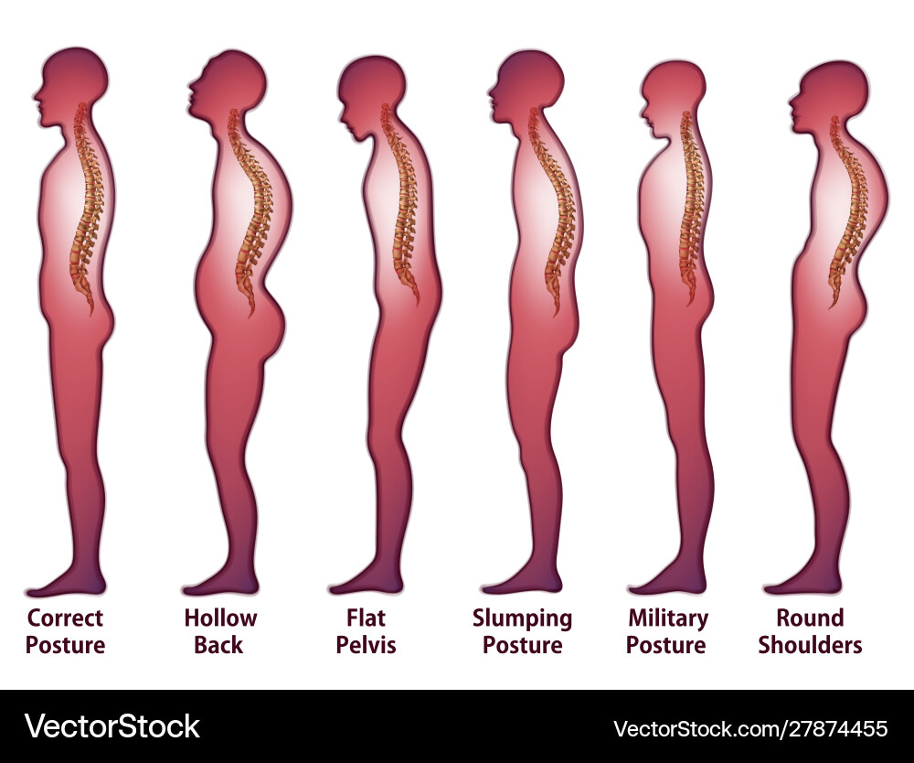 Spine Posture Anatomy & Health Royalty Free Vector Image
