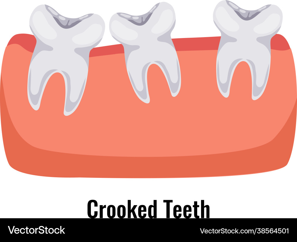 Dental problem poster Royalty Free Vector Image