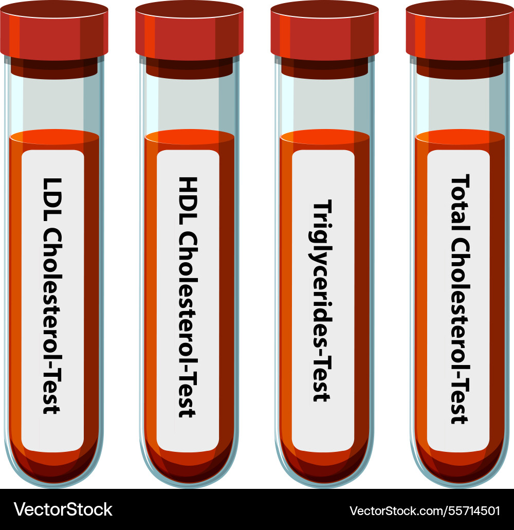 Image of labeled blood test tubes Royalty Free Vector Image