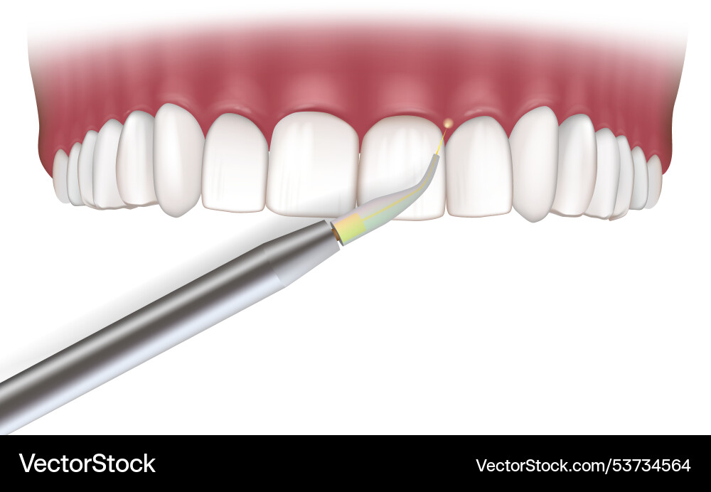 Dental laser with healthy white teeth Royalty Free Vector