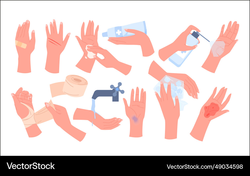Cartoon isolated broken arms with wound bruise Vector Image
