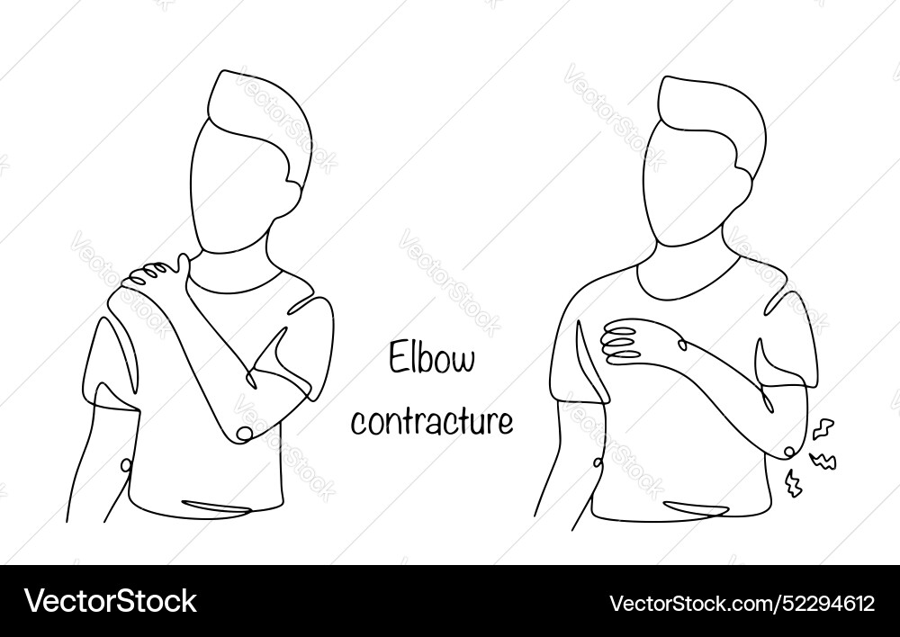 Elbow contracture Royalty Free Vector Image - VectorStock