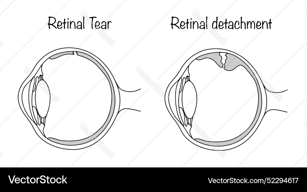 Retina Royalty Free Vector Image - VectorStock