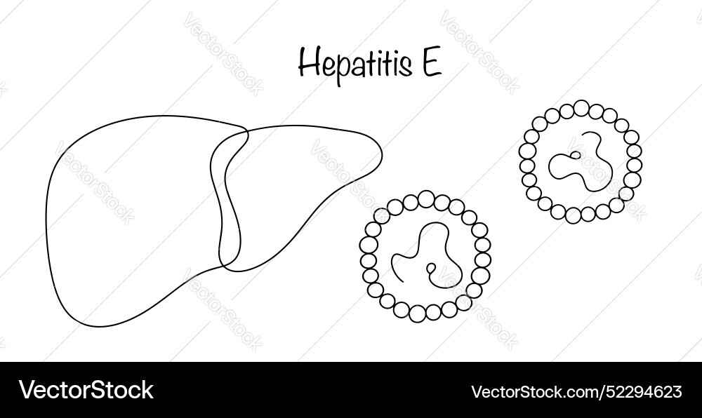 Hepatitis e Royalty Free Vector Image - VectorStock