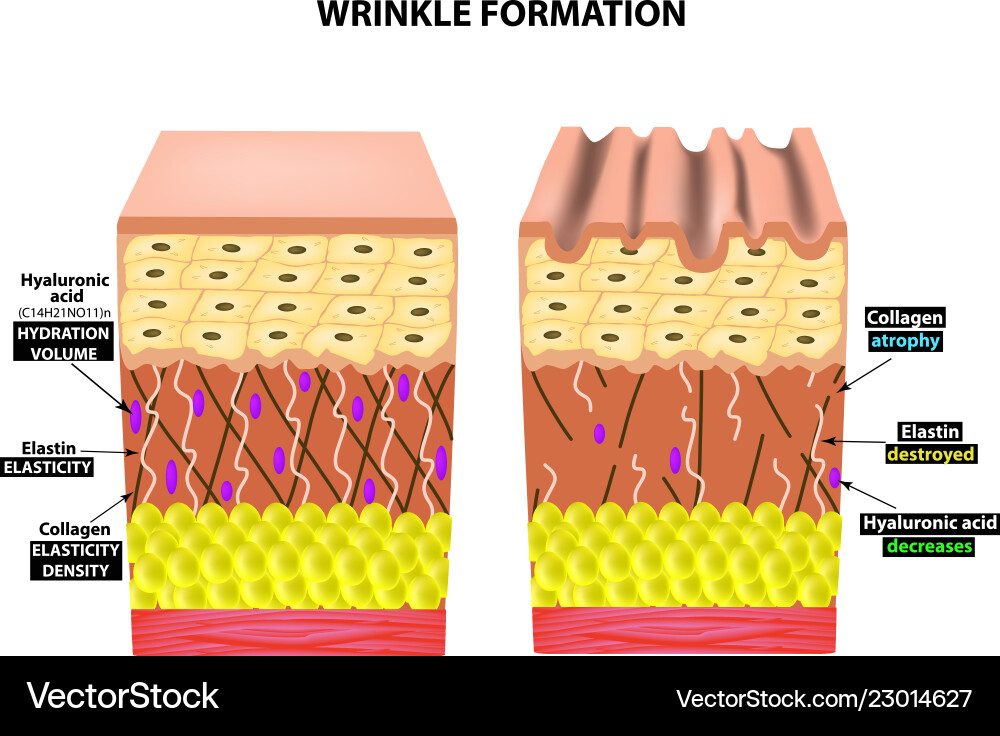 Skin Aging and Wrinkle Structure Royalty Free Vector Image