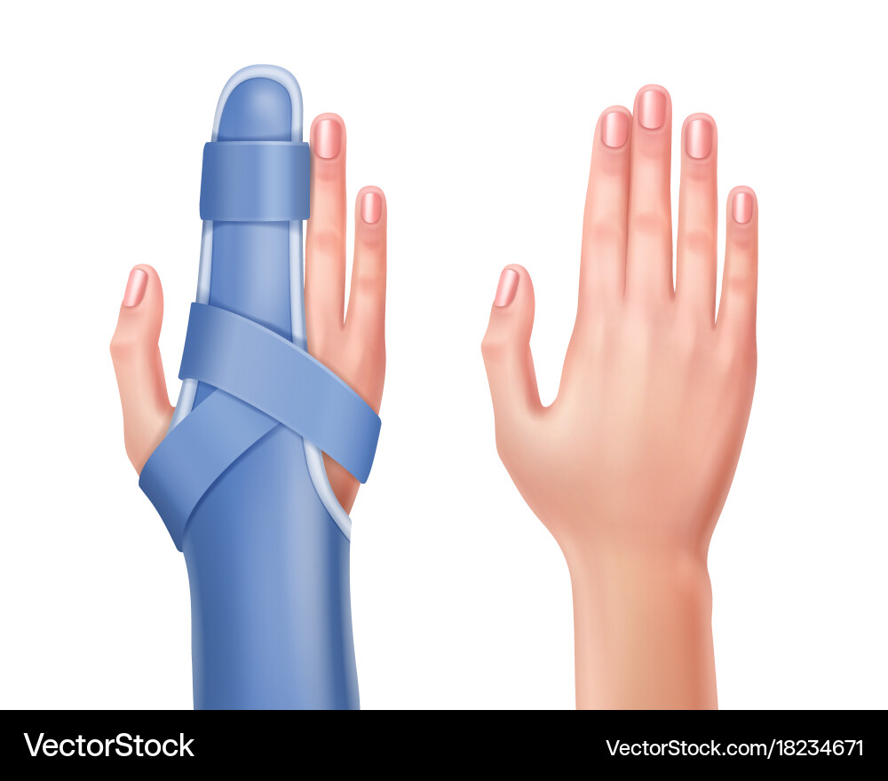 Hand with brace Royalty Free Vector Image - VectorStock