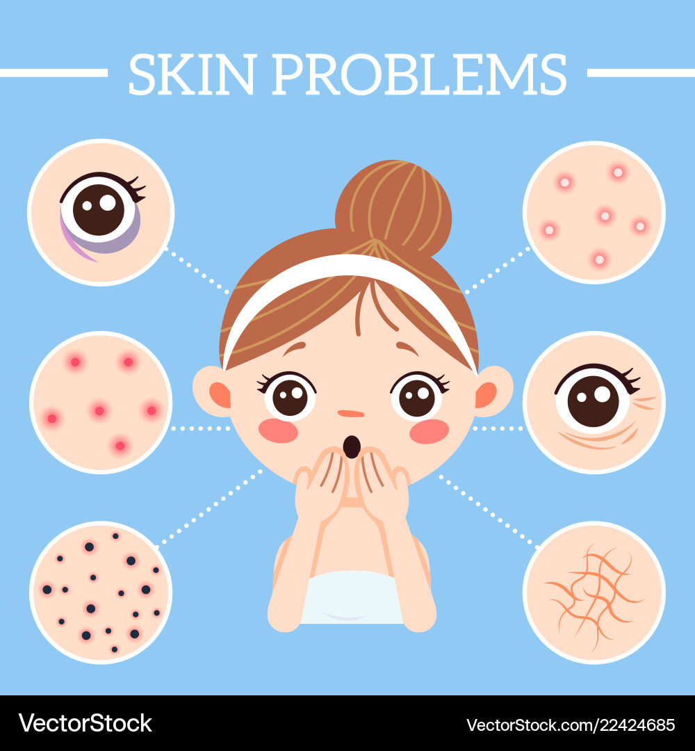 Skin problems infographic ages wrinkles Royalty Free Vector