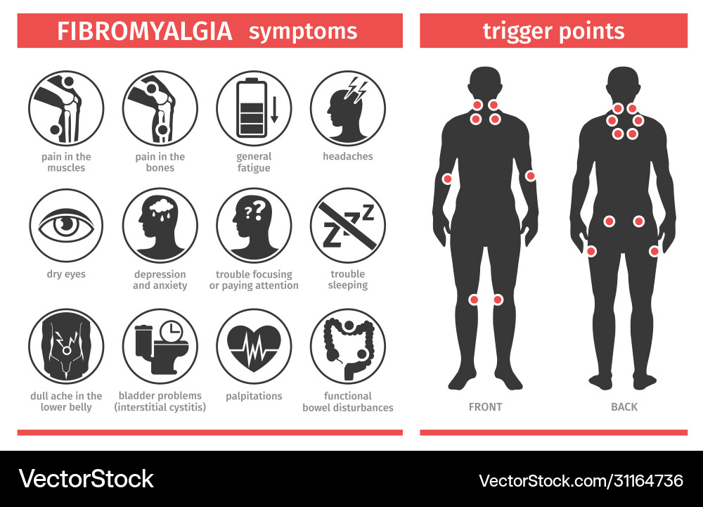 Symptoms and signs fibromyalgia tender points Vector Image