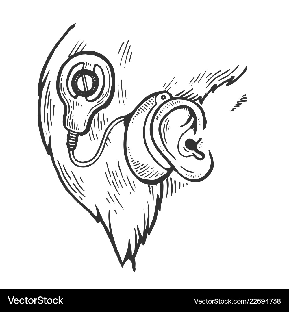 Cochlear implant engraving Royalty Free Vector Image