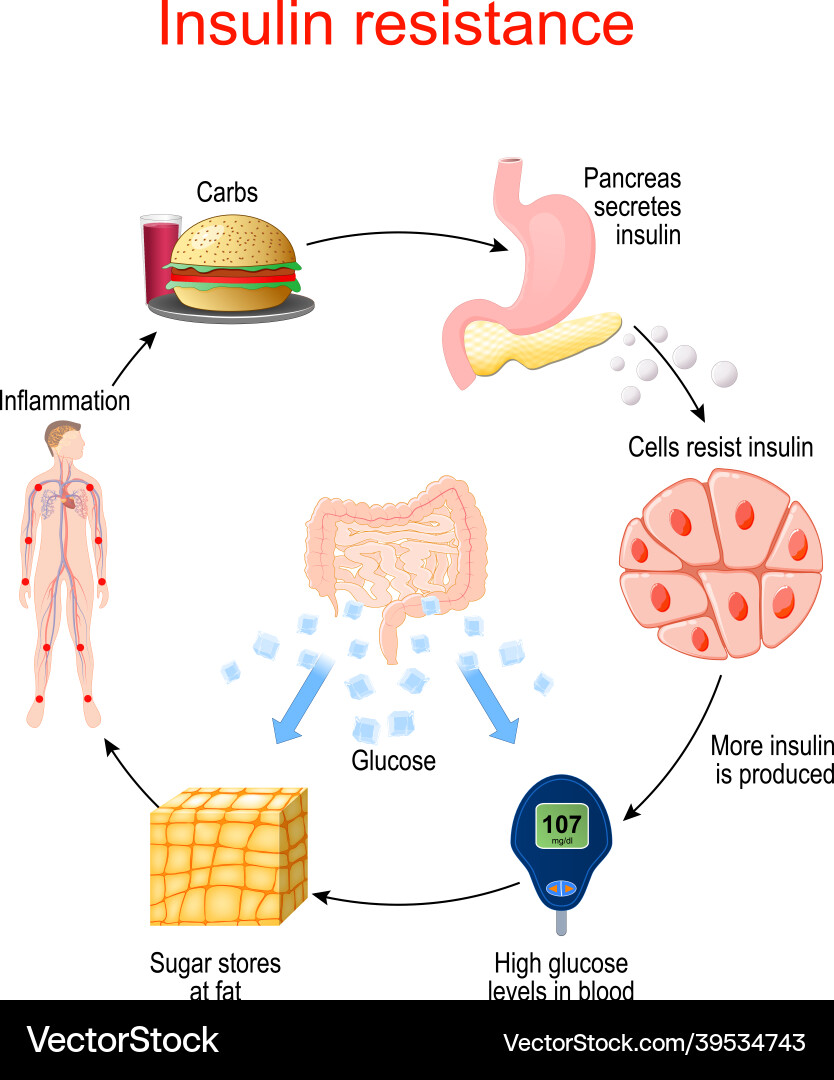 Insulin Resistance Explained Royalty Free Vector Image