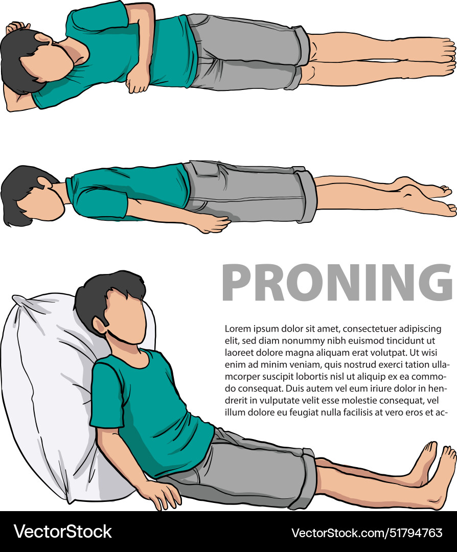 Proning or prone positioning Royalty Free Vector Image