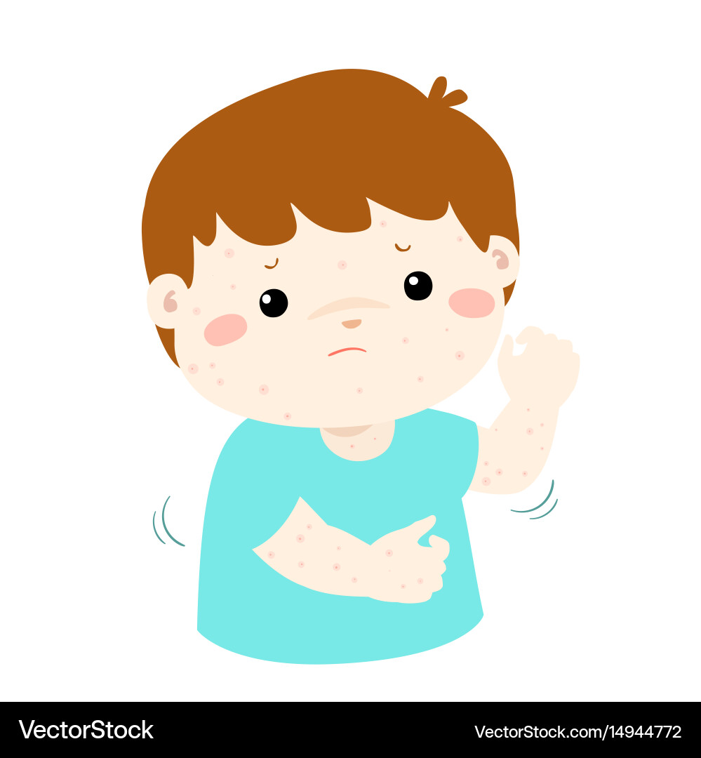 Boy scratching itching rash on his body Royalty Free Vector