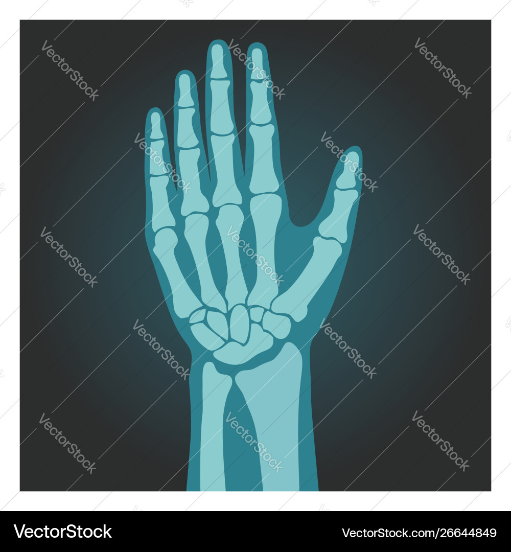 Wrist X-Ray - Human Anatomy Royalty Free Vector Image