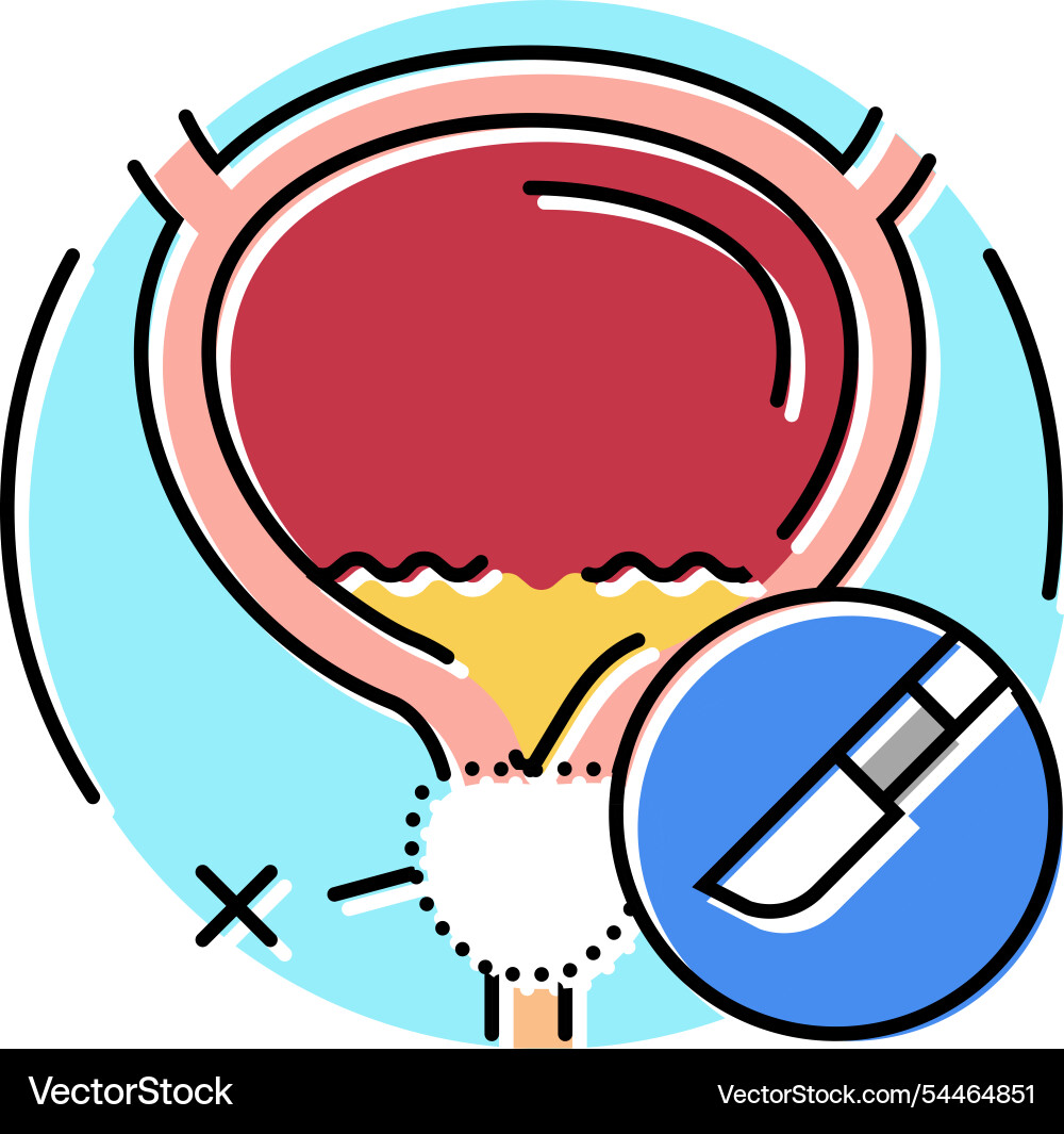 Prostatectomy urology color icon Royalty Free Vector Image