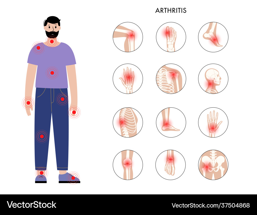 Arthritis in man silhouette Royalty Free Vector Image