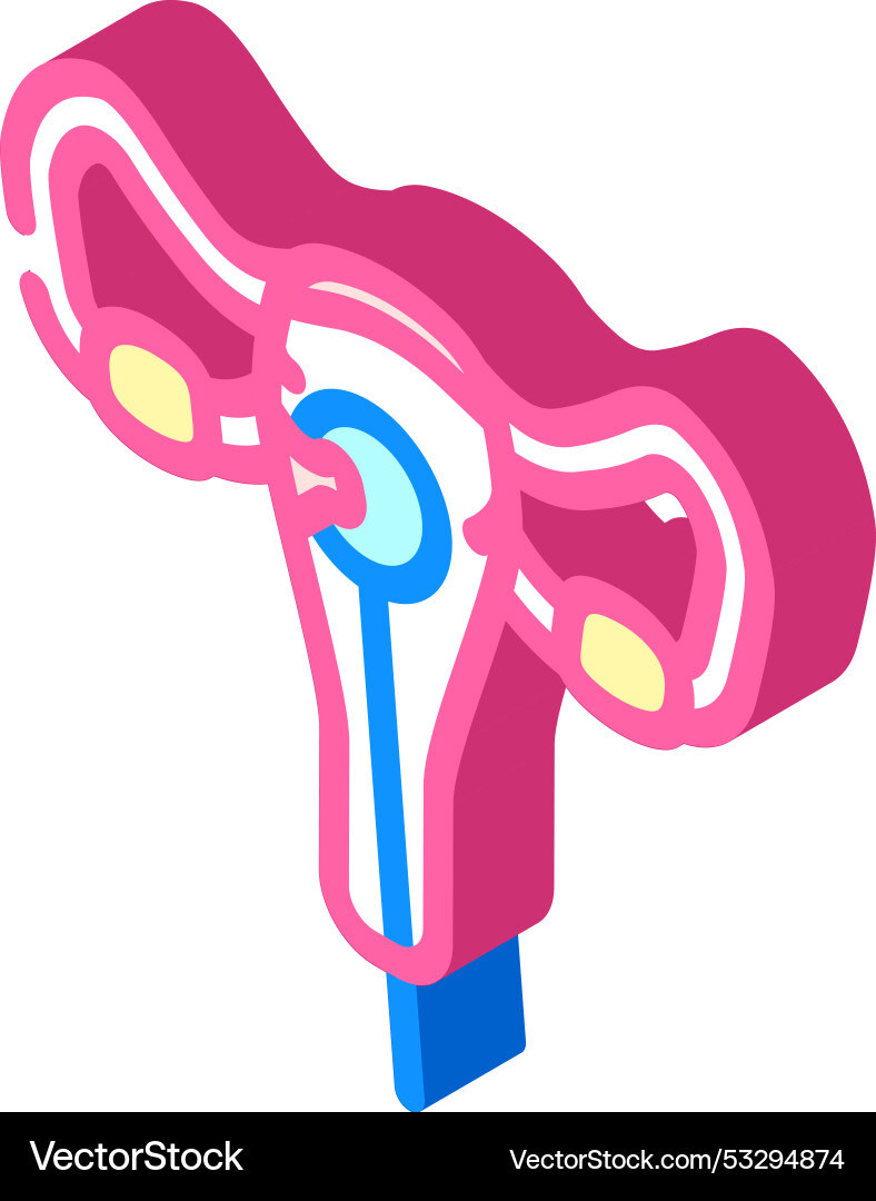 Dilation and curettage surgery isometric icon Vector Image