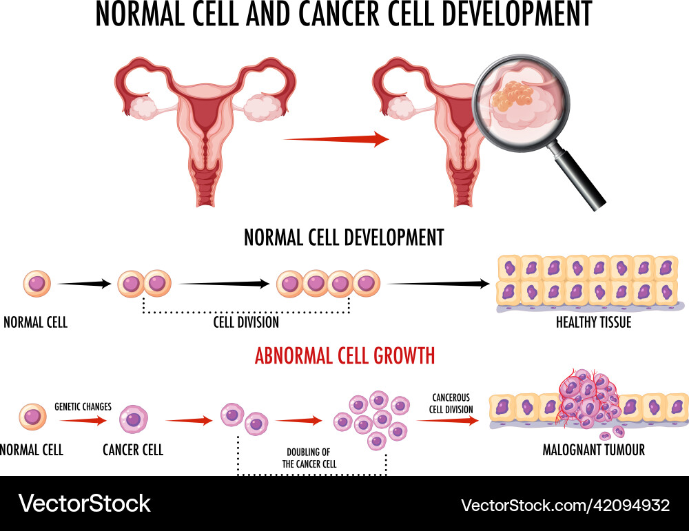 Diagram showing normal and cancer cell Royalty Free Vector