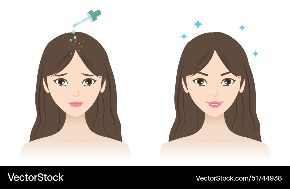 Before and after anti dandruff treatment Vector Image