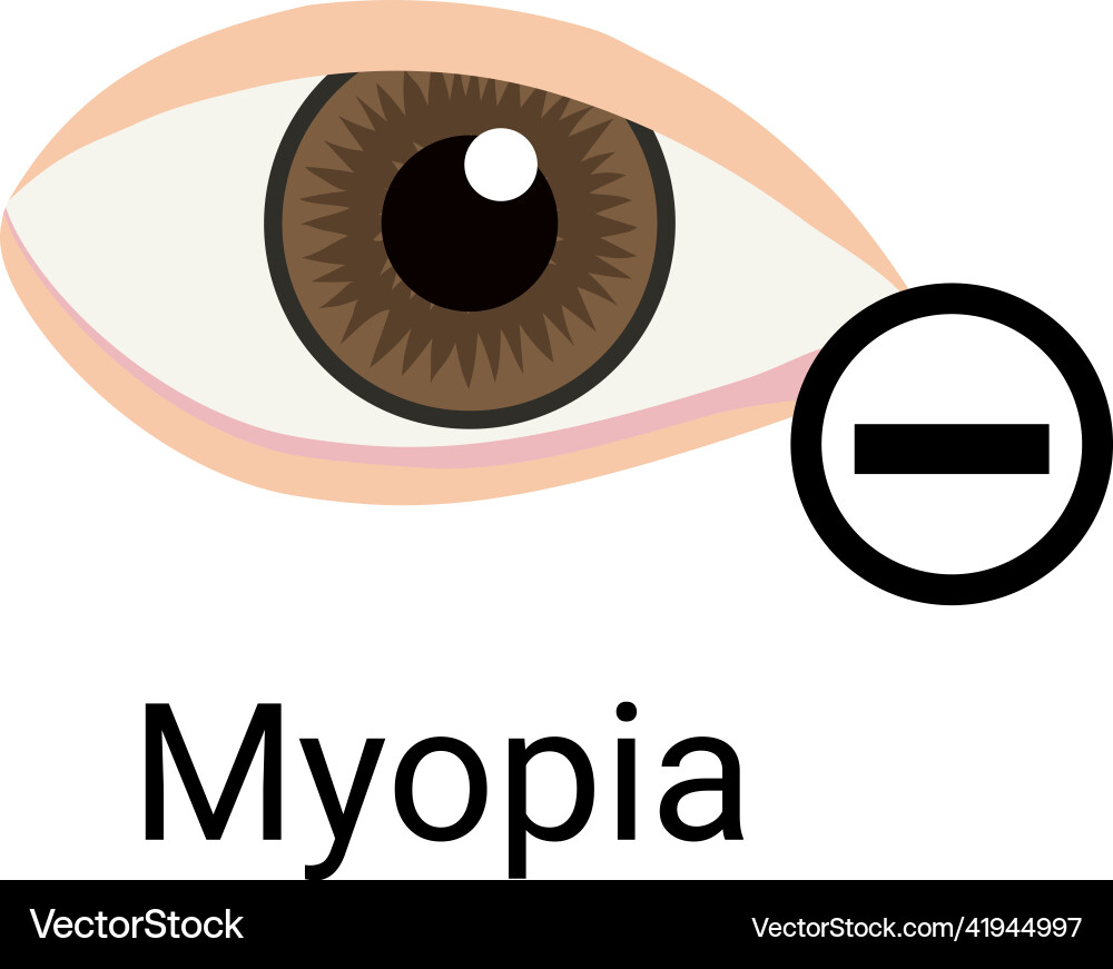 Myopia eye care composition Royalty Free Vector Image