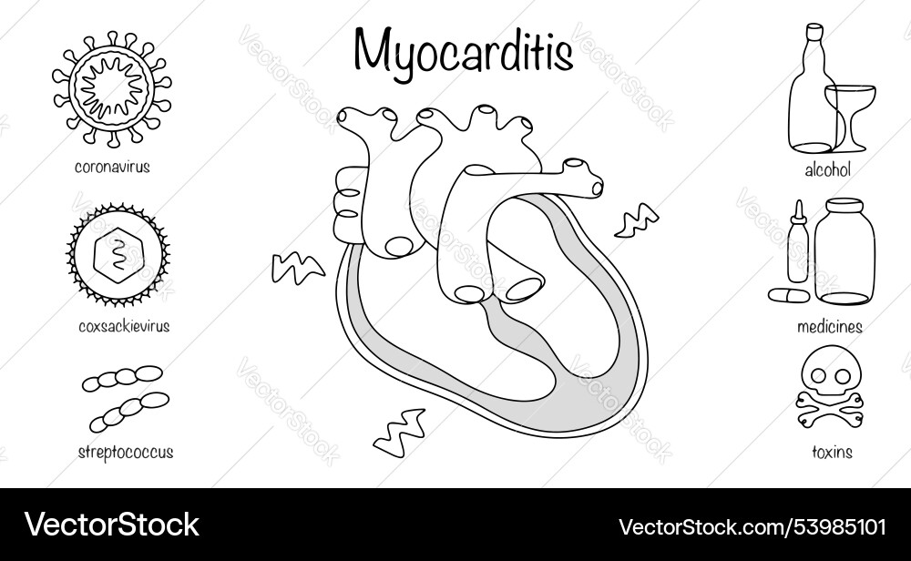 Myocarditis Royalty Free Vector Image - VectorStock