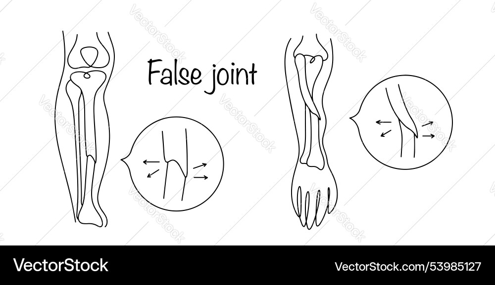 False joint Royalty Free Vector Image - VectorStock