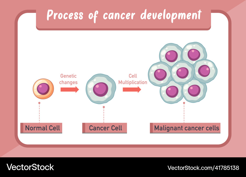 Process of cancer development infographic Vector Image