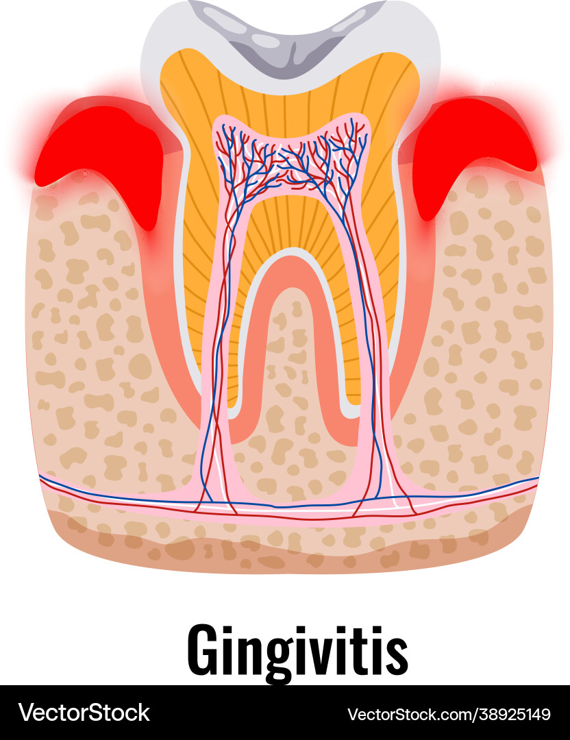 Dental problems poster Royalty Free Vector Image