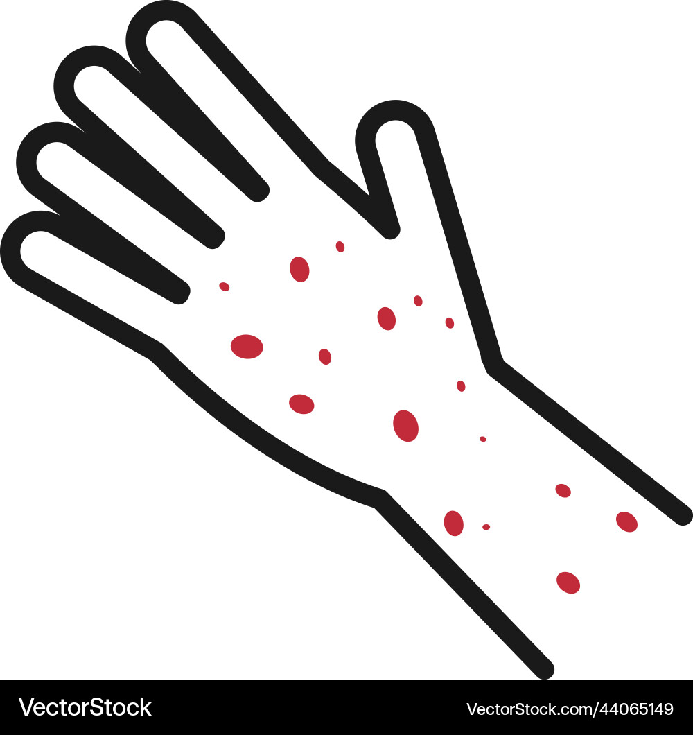 Red rash on human hand disease symptom icon Vector Image