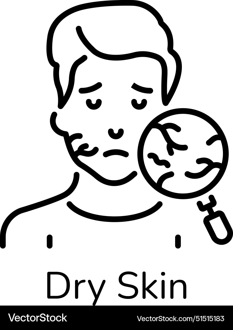 Dry skin Royalty Free Vector Image - VectorStock