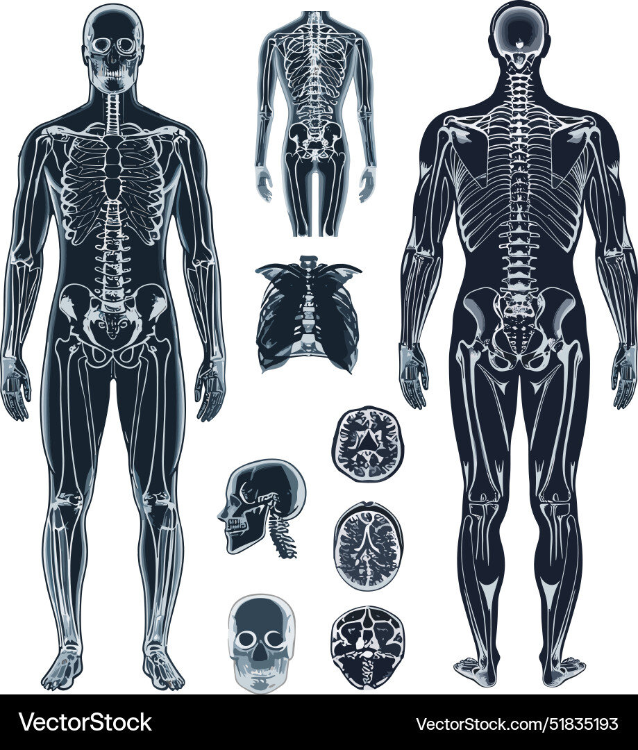 Human body x-ray cartoon set head torso Royalty Free Vector