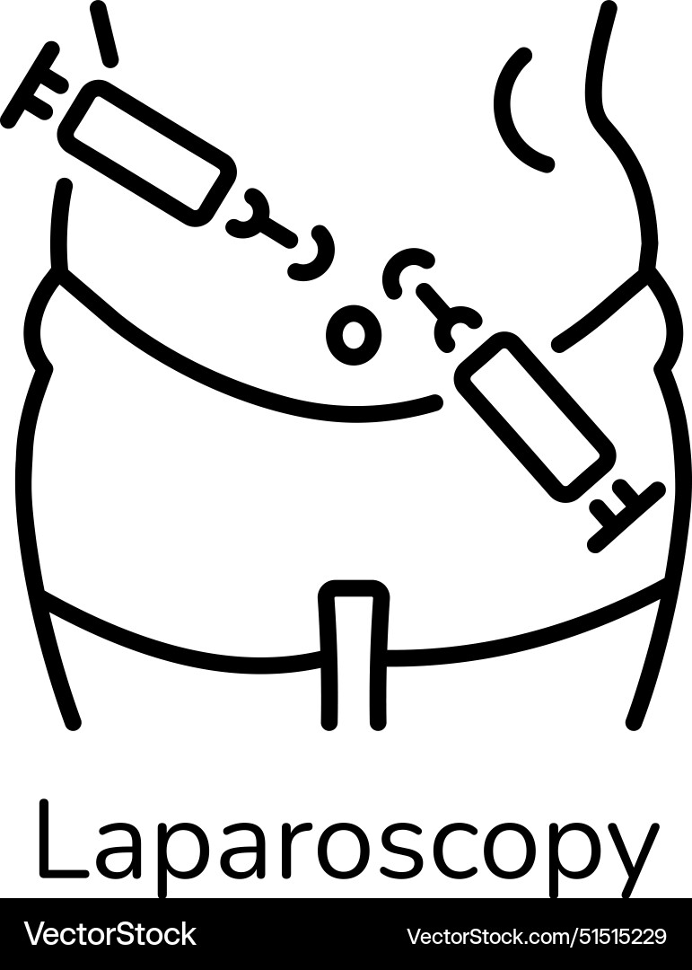 Laparoscopy Royalty Free Vector Image - VectorStock
