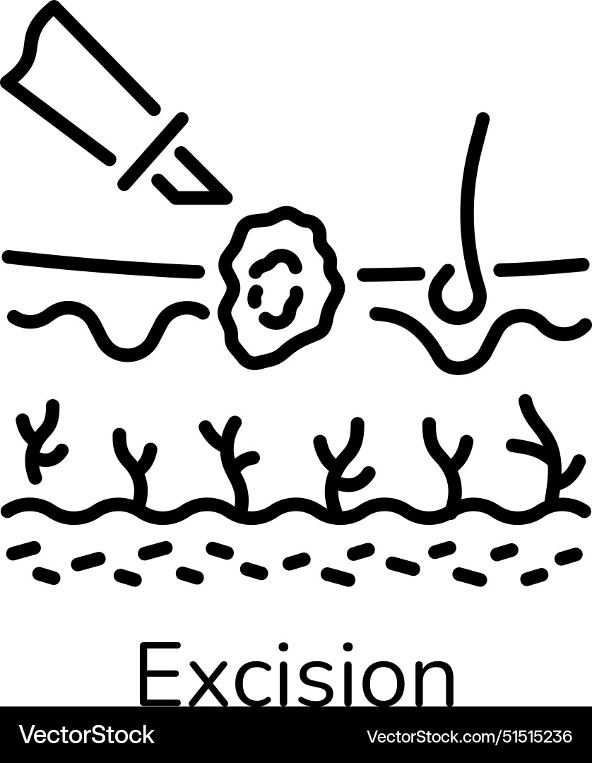 Excision Royalty Free Vector Image - VectorStock Excision Royalty Free Vector Image - VectorStock