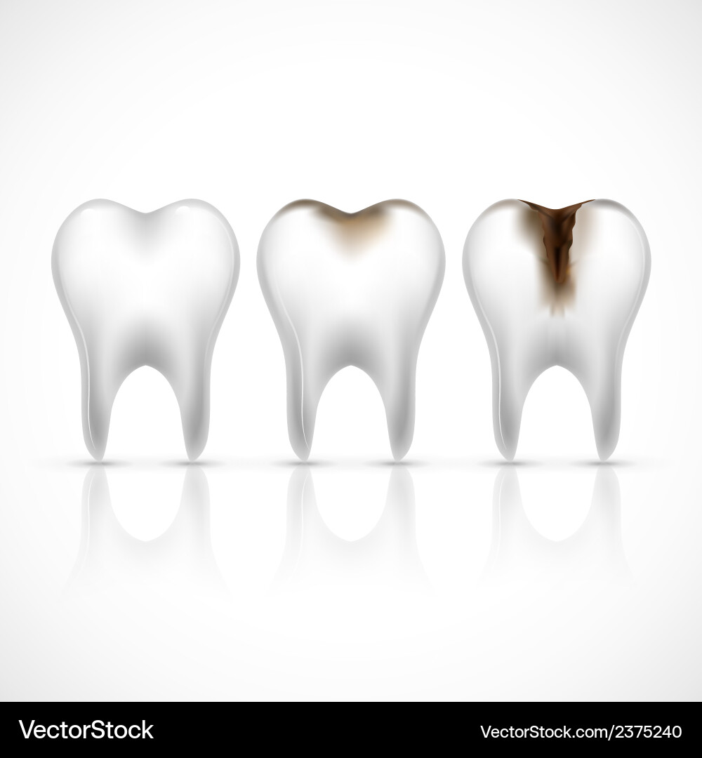 Teeth realistic set Royalty Free Vector Image - VectorStock