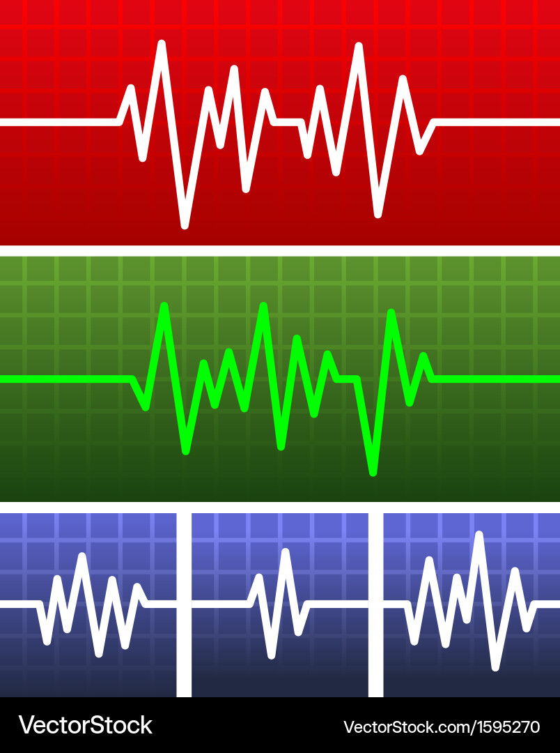 Electrocardiogram Royalty Free Vector Image - VectorStock