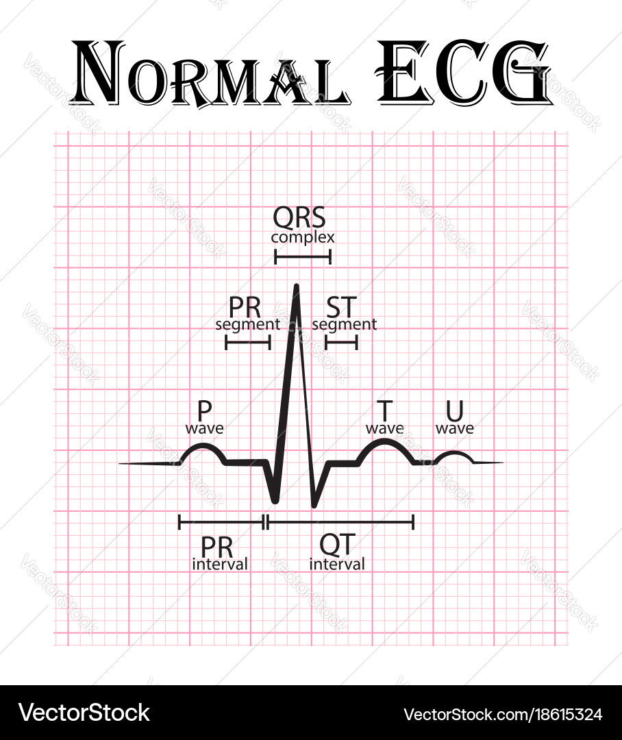 Normal ECG Waveform Royalty Free Vector Image - VectorStock