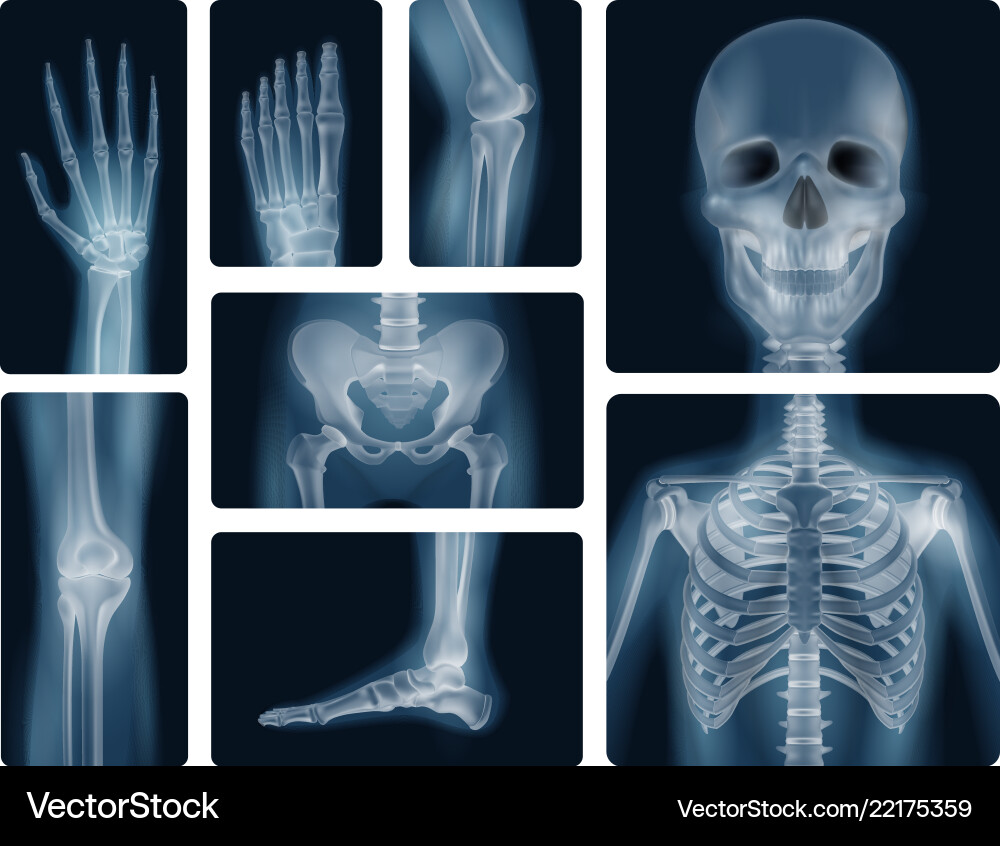 Human bones realistic x-ray shots Royalty Free Vector Image