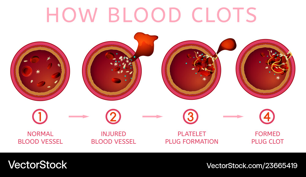 Blood clotting process Royalty Free Vector Image