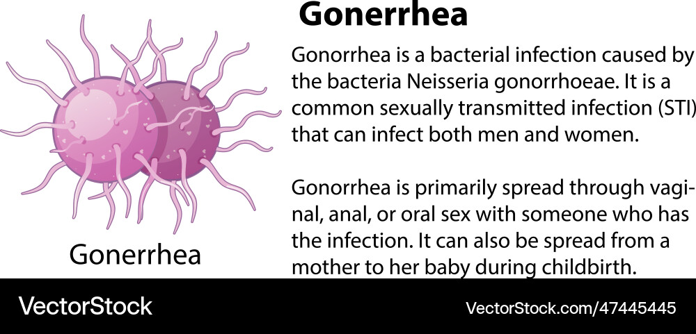Gonorrhea virus with explanation Royalty Free Vector Image