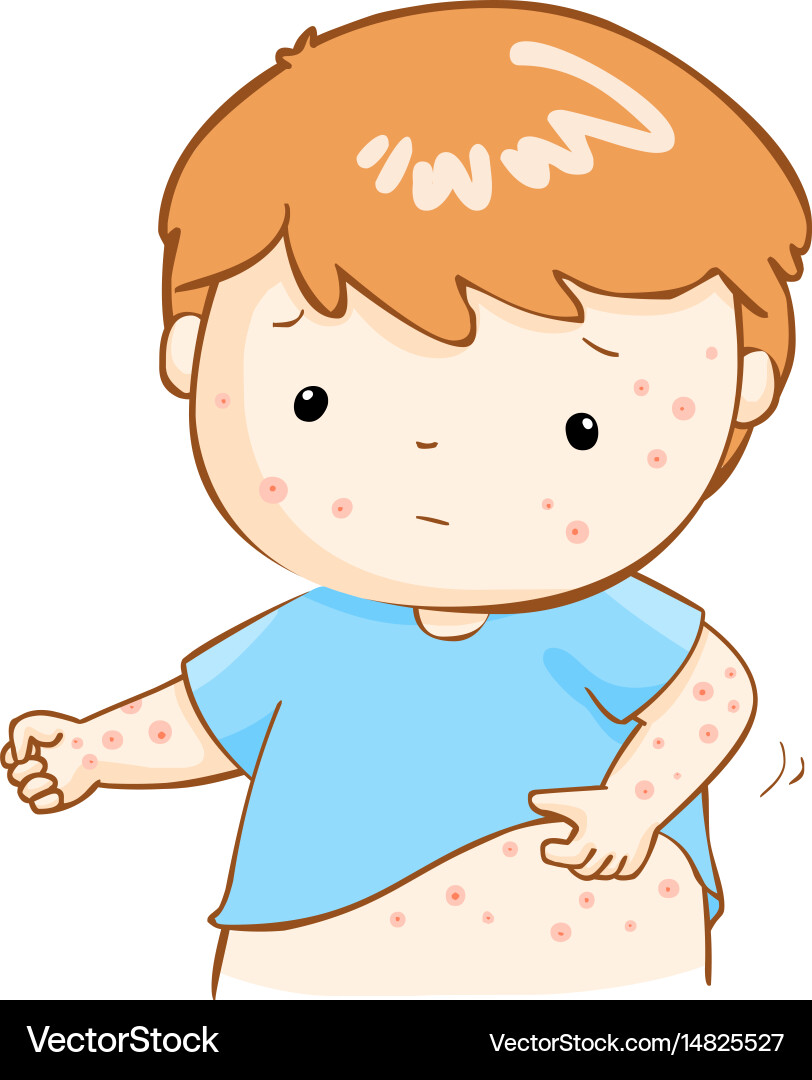 Boy scratching itching rash on his body Royalty Free Vector