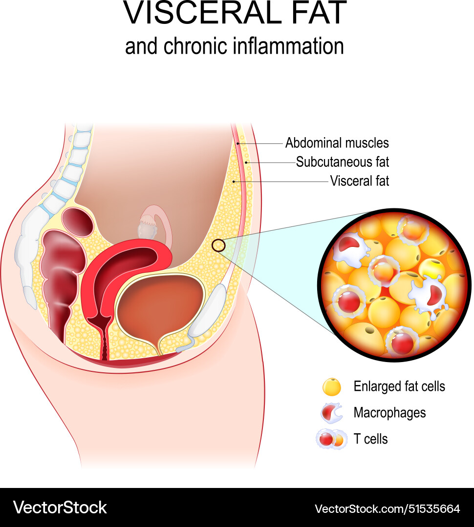 Visceral fat and chronic inflammation Royalty Free Vector