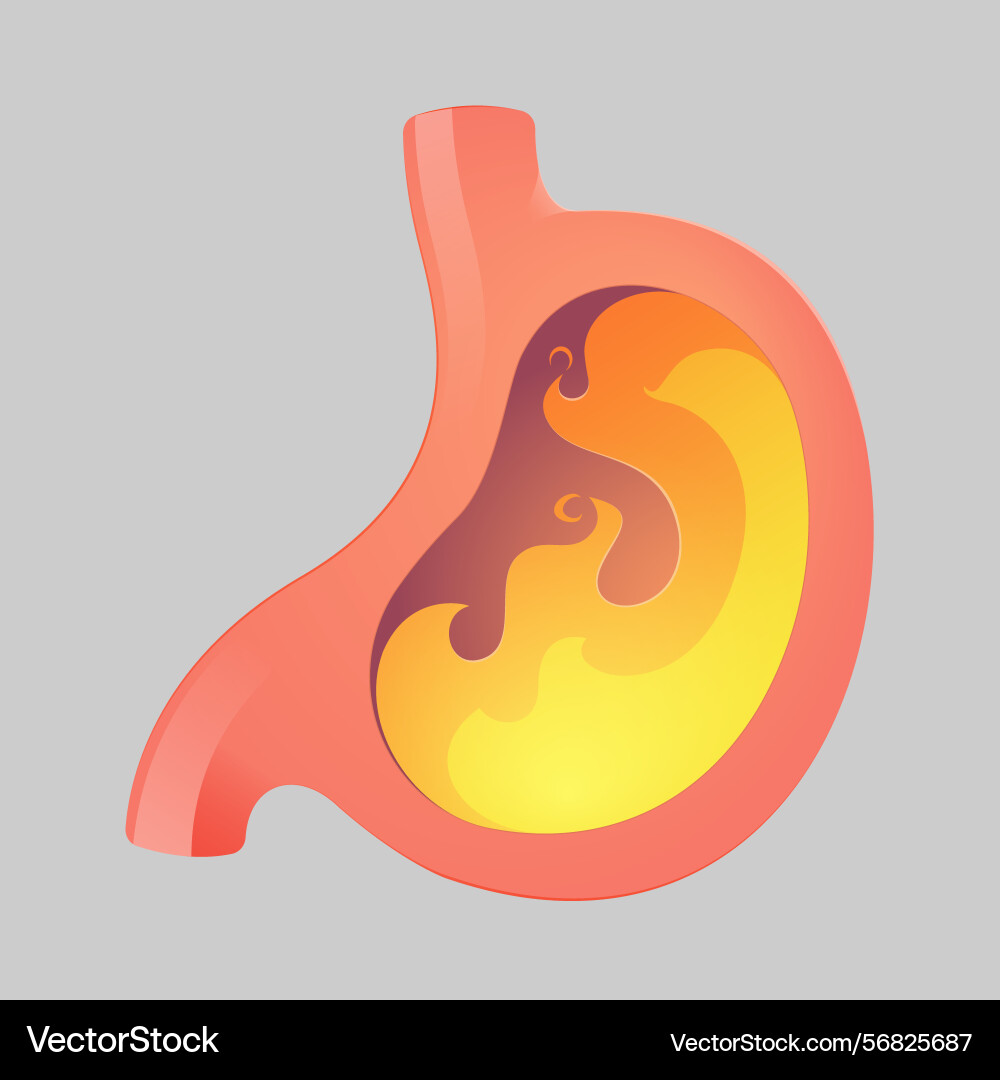 Acid Reflux Or Heartburn Royalty Free Vector Image