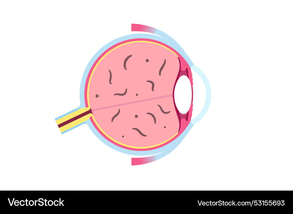 Myodesopsia eye floaters Royalty Free Vector Image