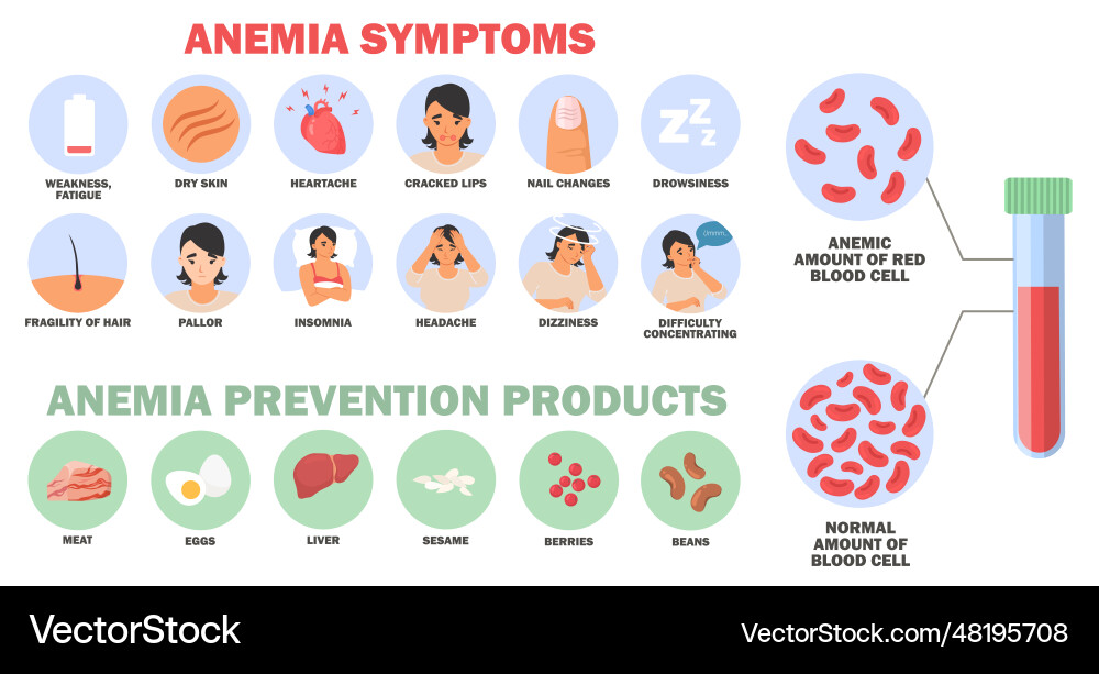 Anemia symptoms and prevention products info Vector Image